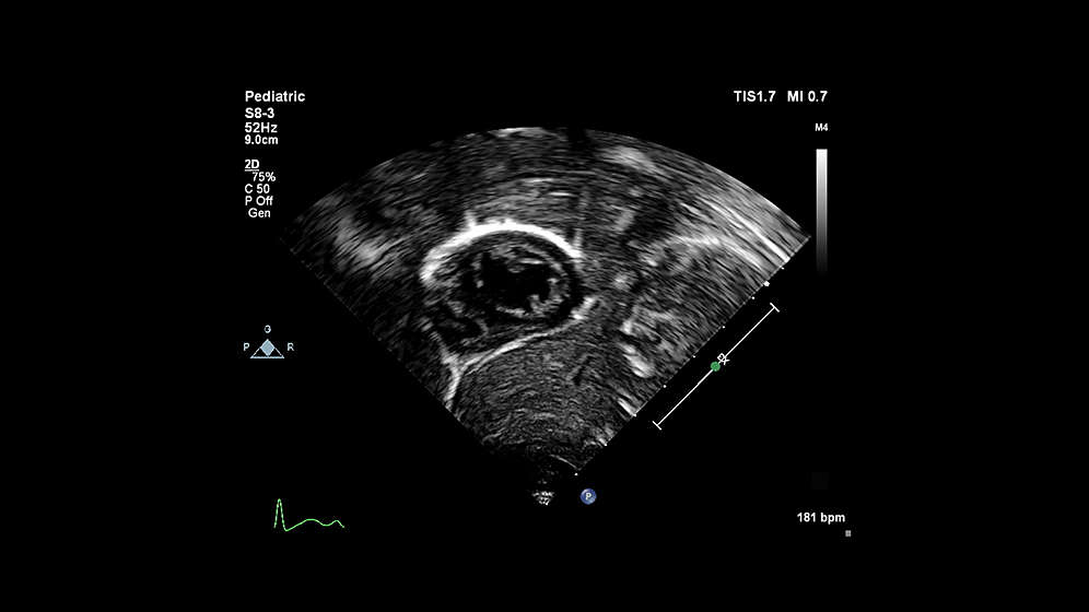 Epiq 7 | Külzer Medizintechnik GmbH